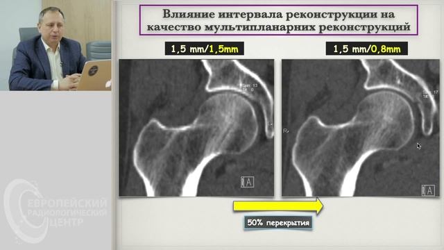 Часть 3. Основные параметры сканирования. Андрей Мангов