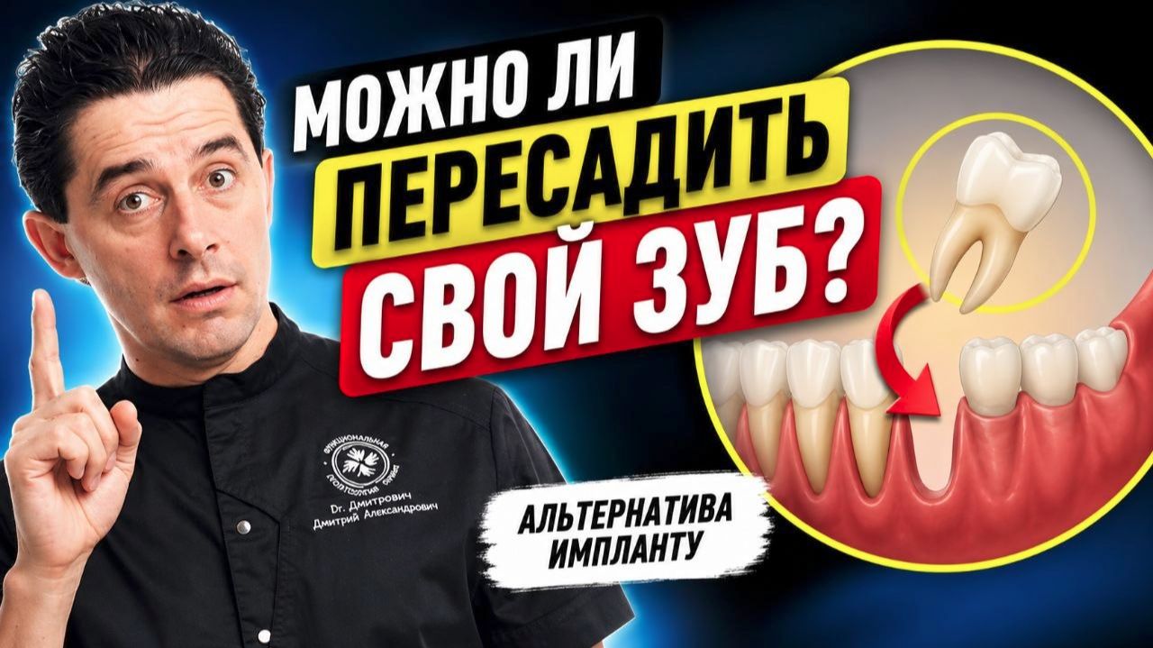 Имплантация