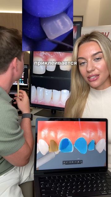 Виниры