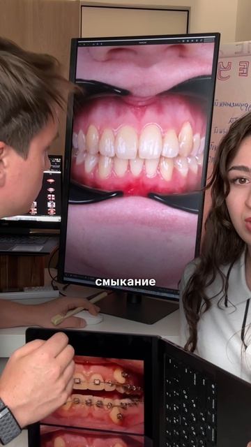 Брекеты