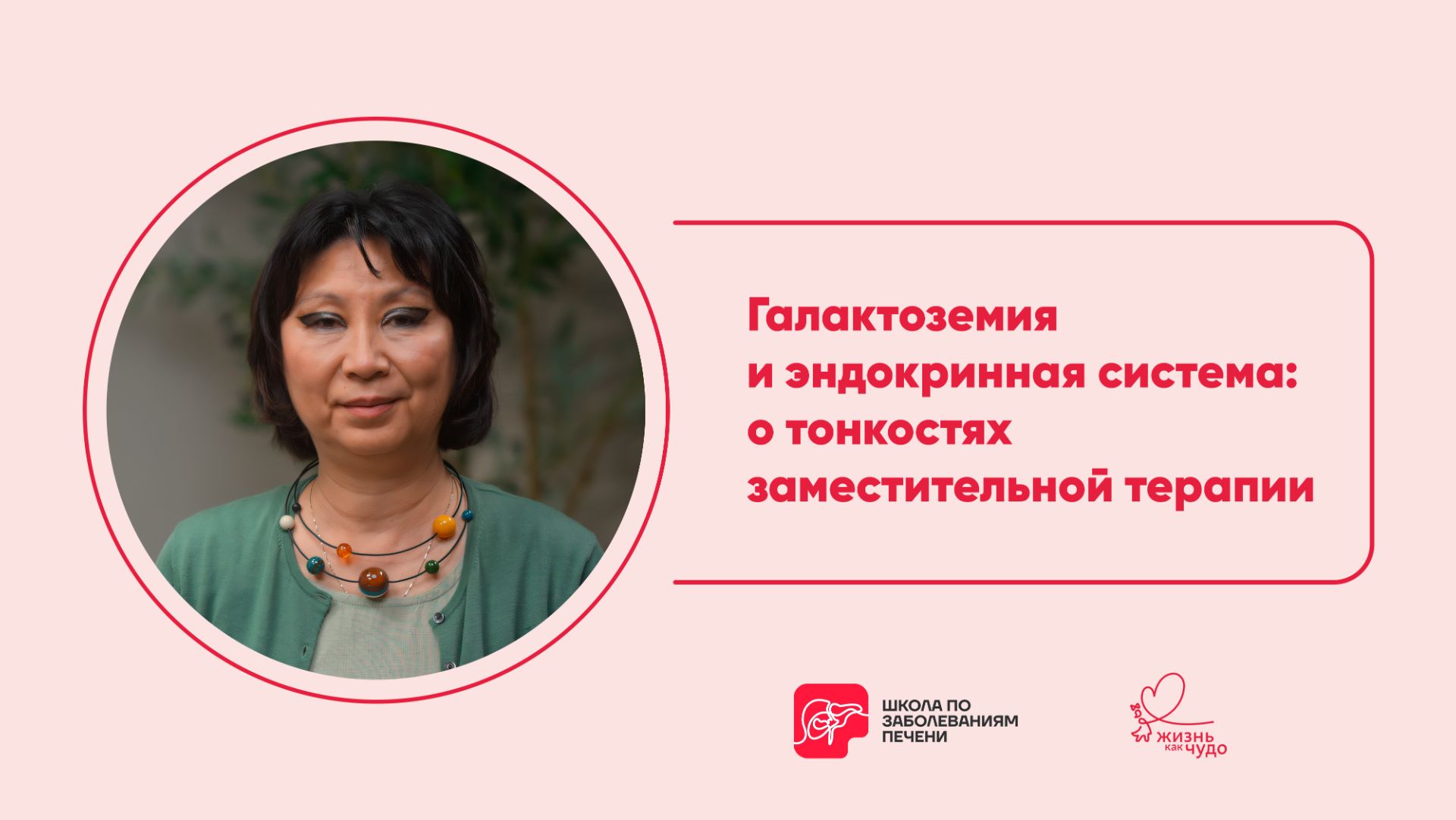 Галактоземия