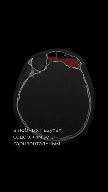 Клинические случаи