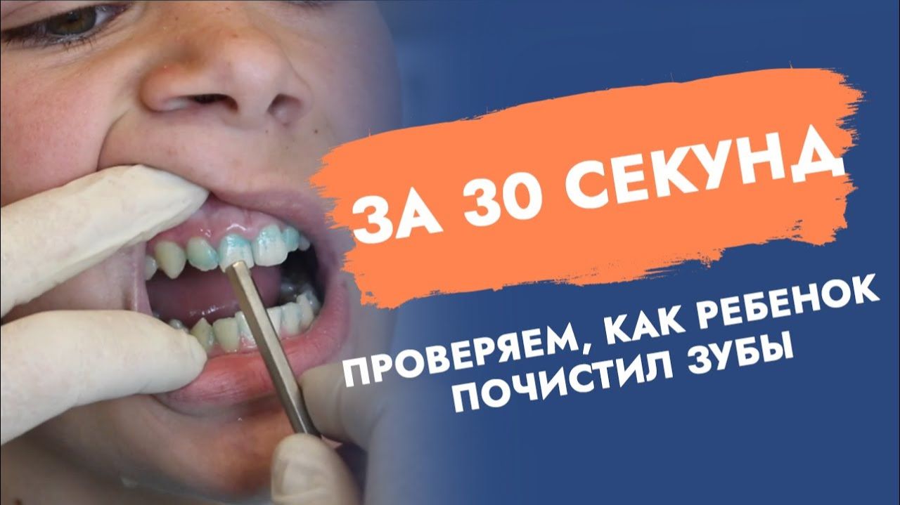 Уход за полостью рта