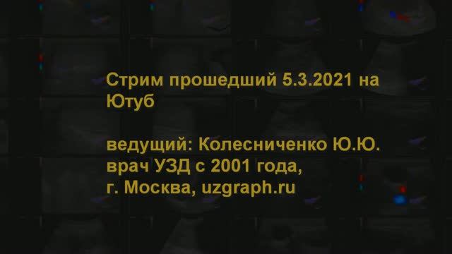 Стримы