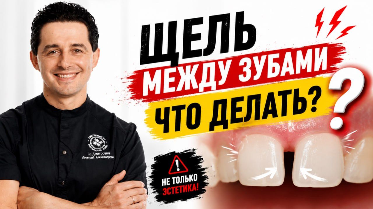 Исправление Прикуса