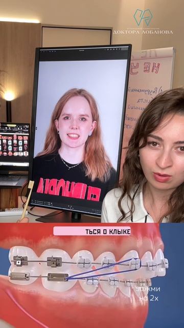 Зуб сильно разрушен под  десну?