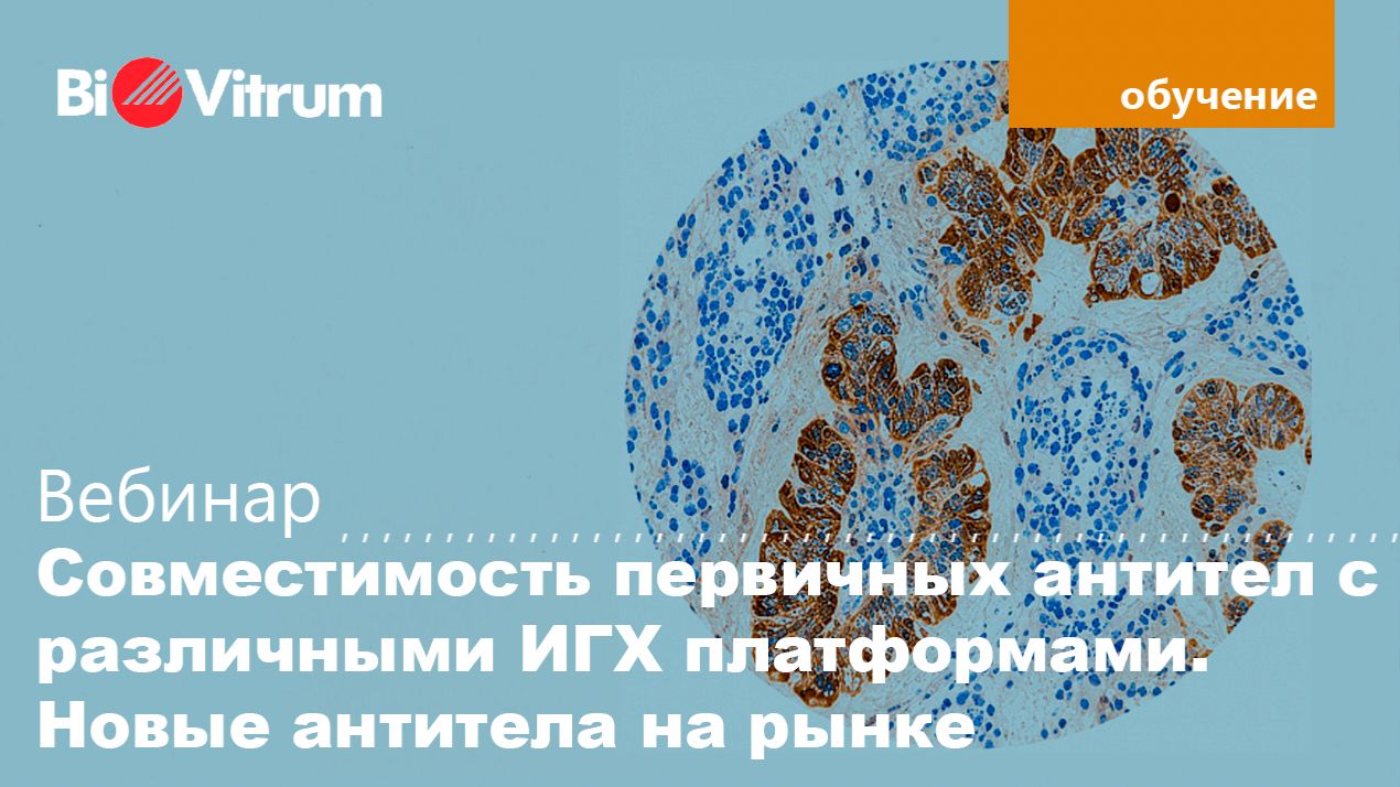 Онкодиагностика