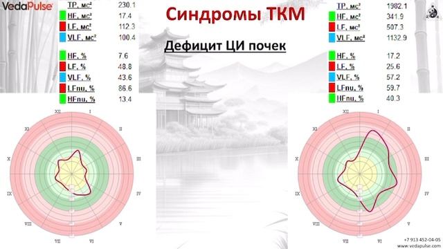 Веда Пульс