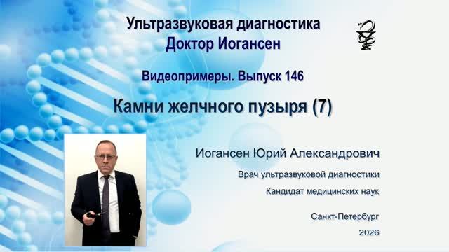 Ультразвуковая диагностика (УЗИ). Доктор Иогансен. Видеопримеры.