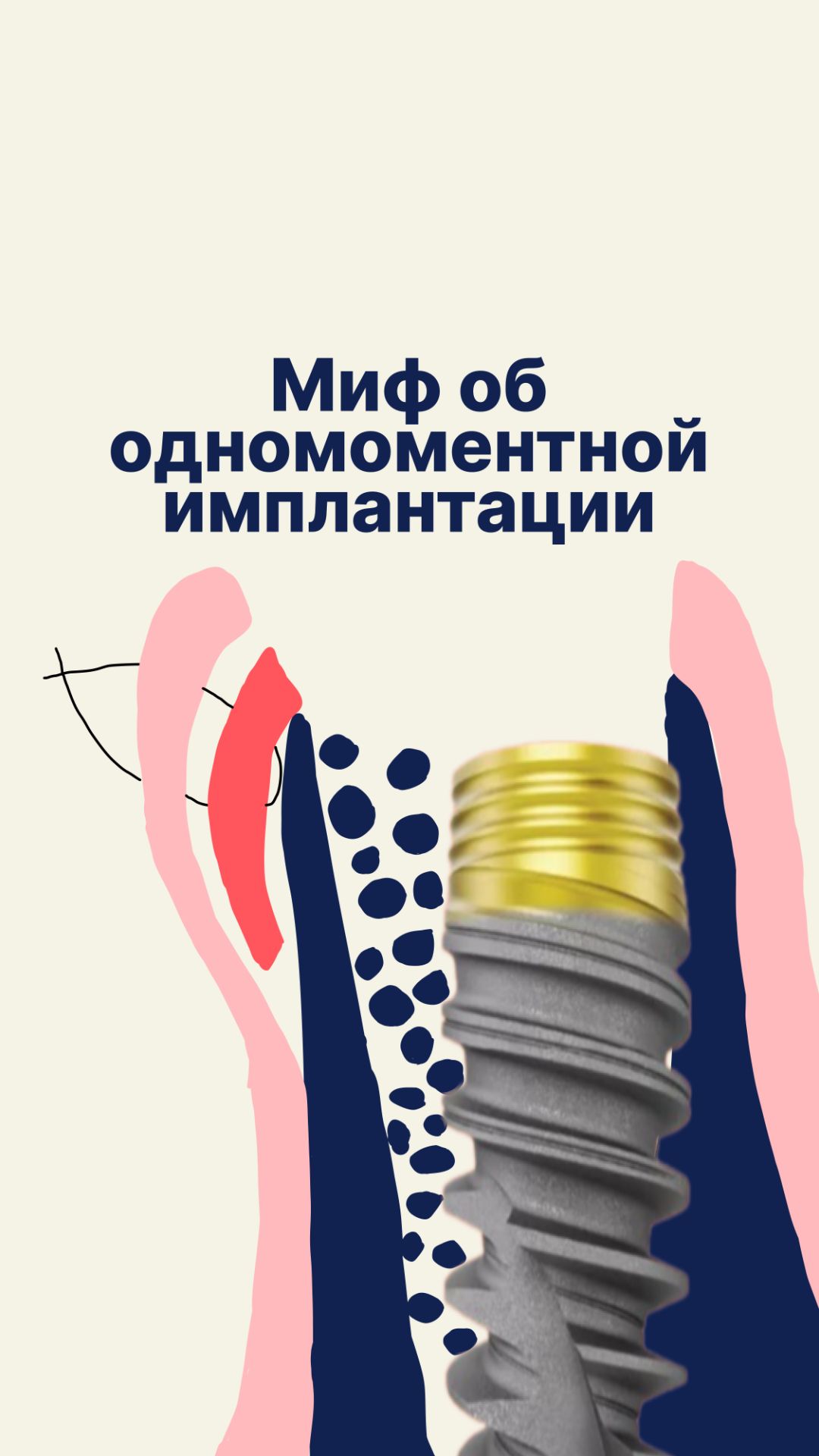 Хирургические методики