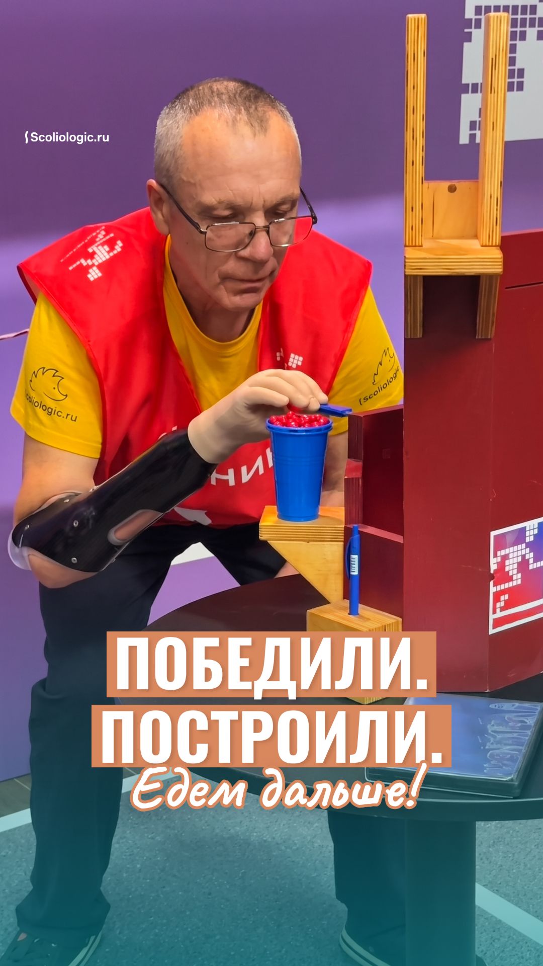 Протезы рук