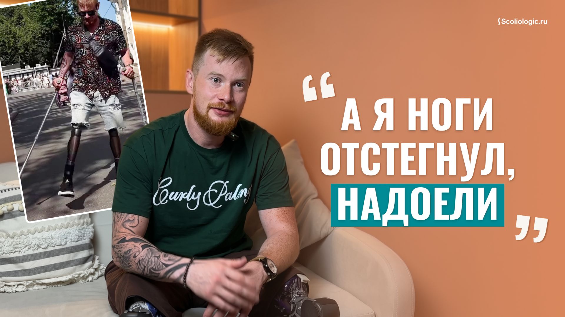 Протезы ног