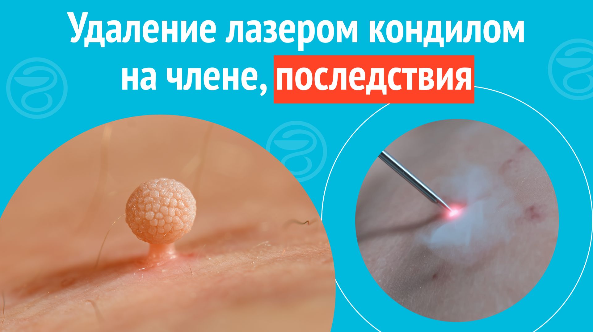Процедуры