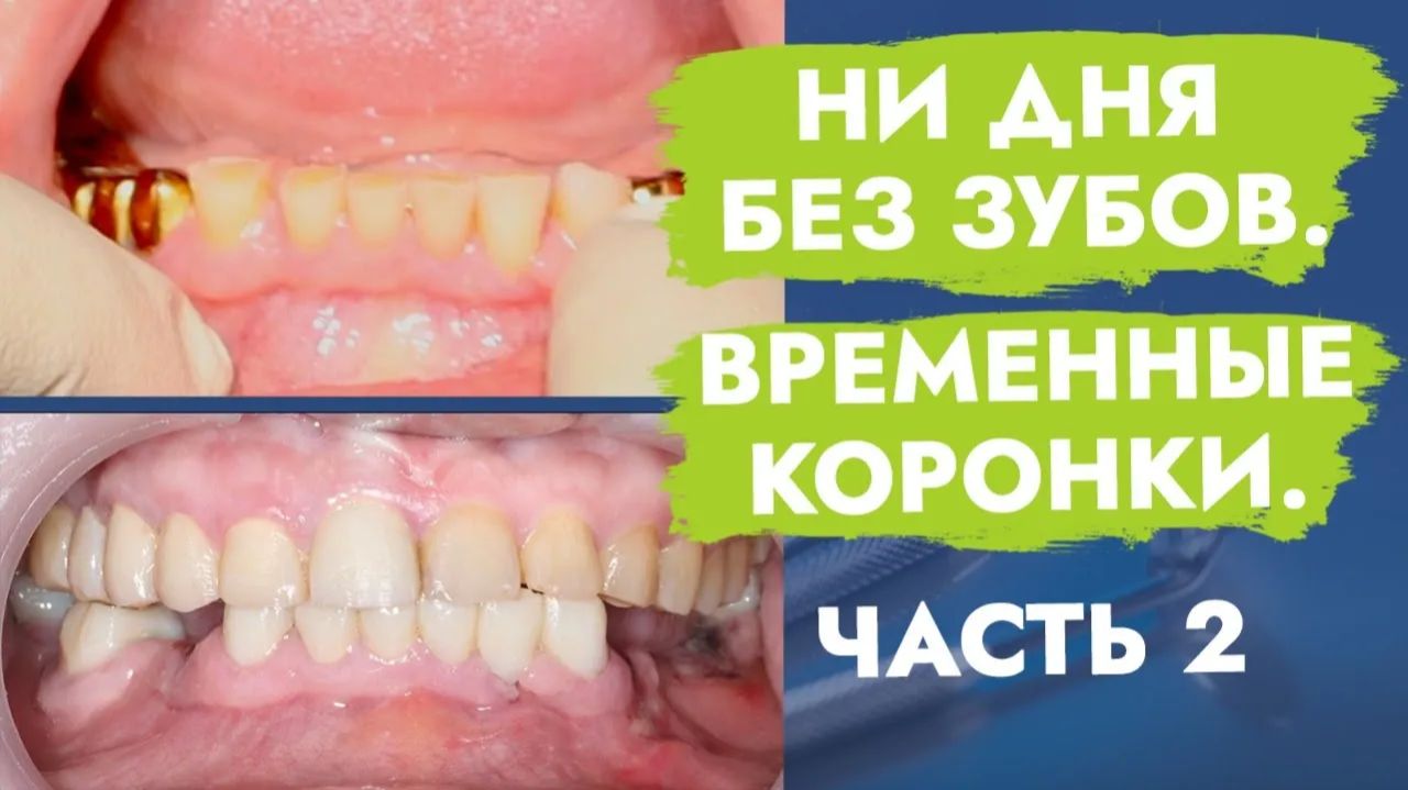 Стоматолог-ортопед. Несъёмные протезы.
