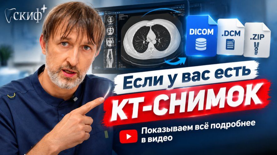 Компьютерная томография