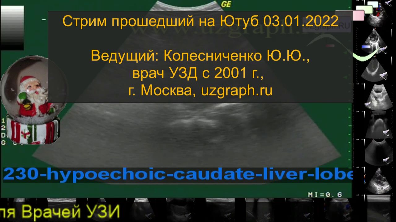 Стримы