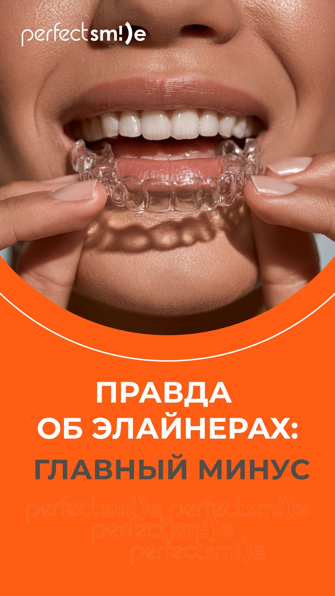Ортодонтическое лечение