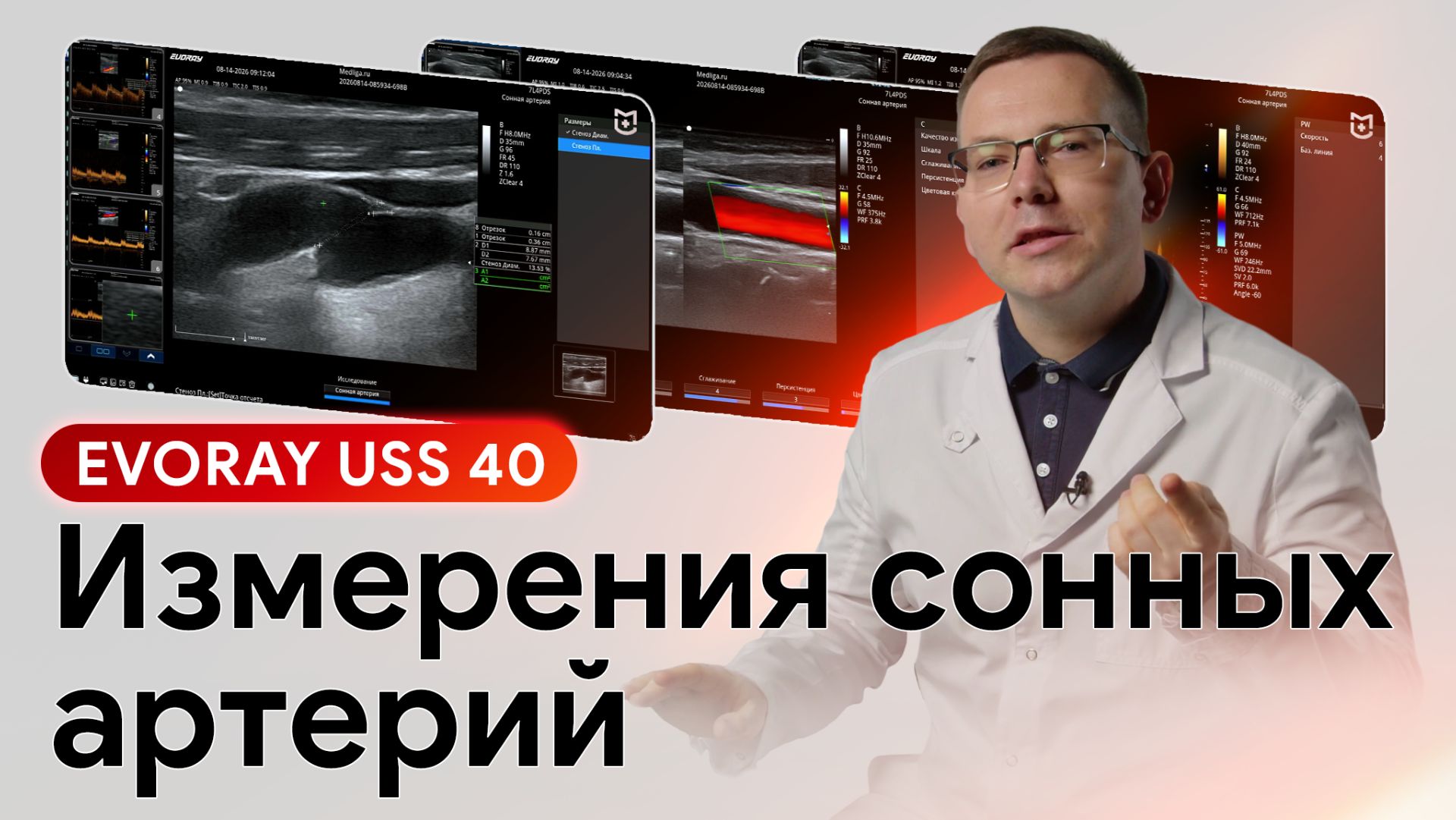 УЗИ сосудов и артерий