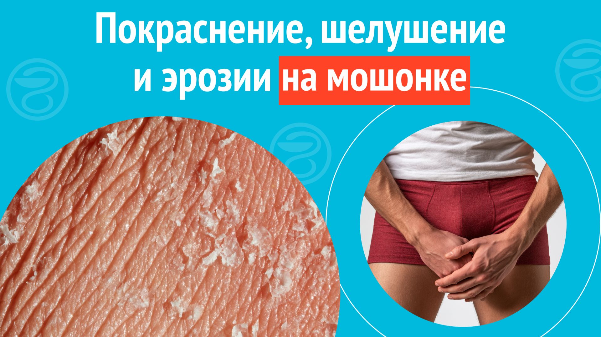 Мужские болезни