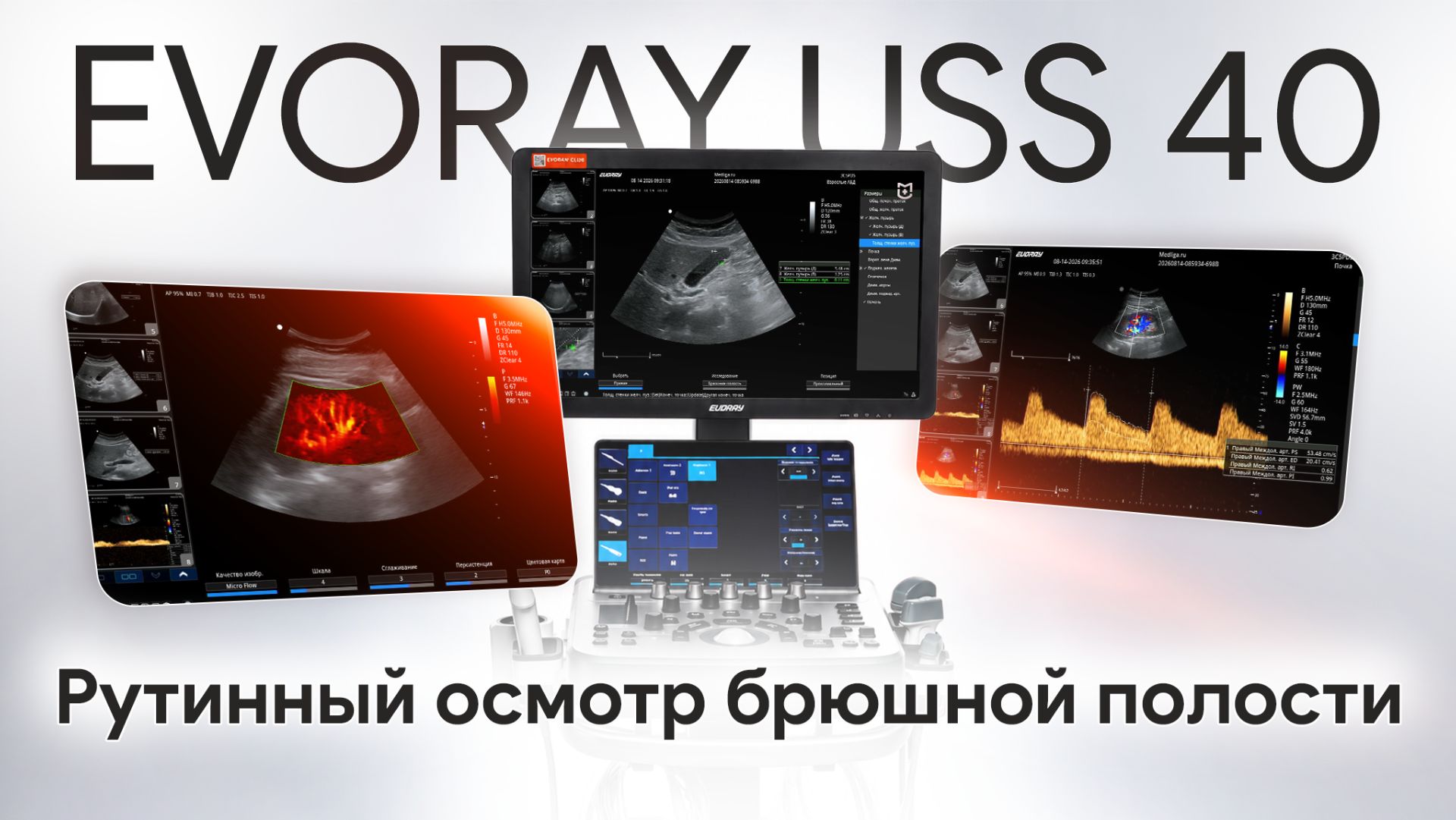 УЗИ органов брюшной полости (ОБП)
