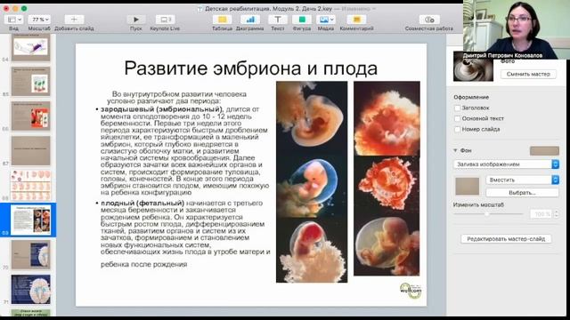 Особые детки