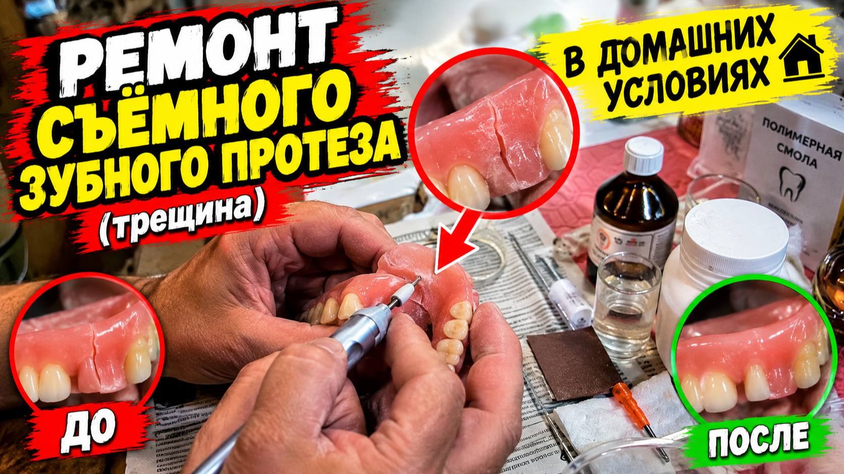 Здоровье