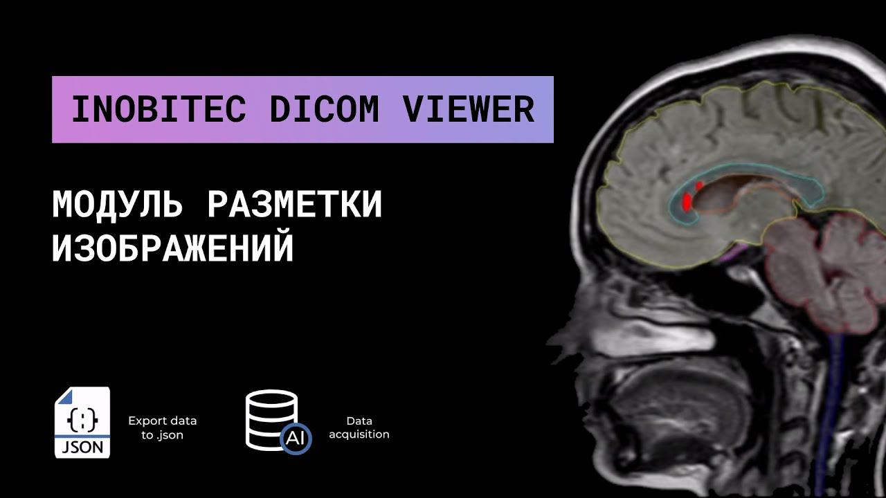 Дополнительный модуль разметки изображений в Инобитек DICOM-Просмотрщике редакции Pro