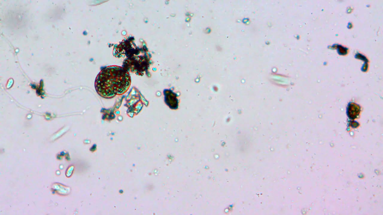 Что можно увидеть в микроскоп в капле обычной прудовой воды.