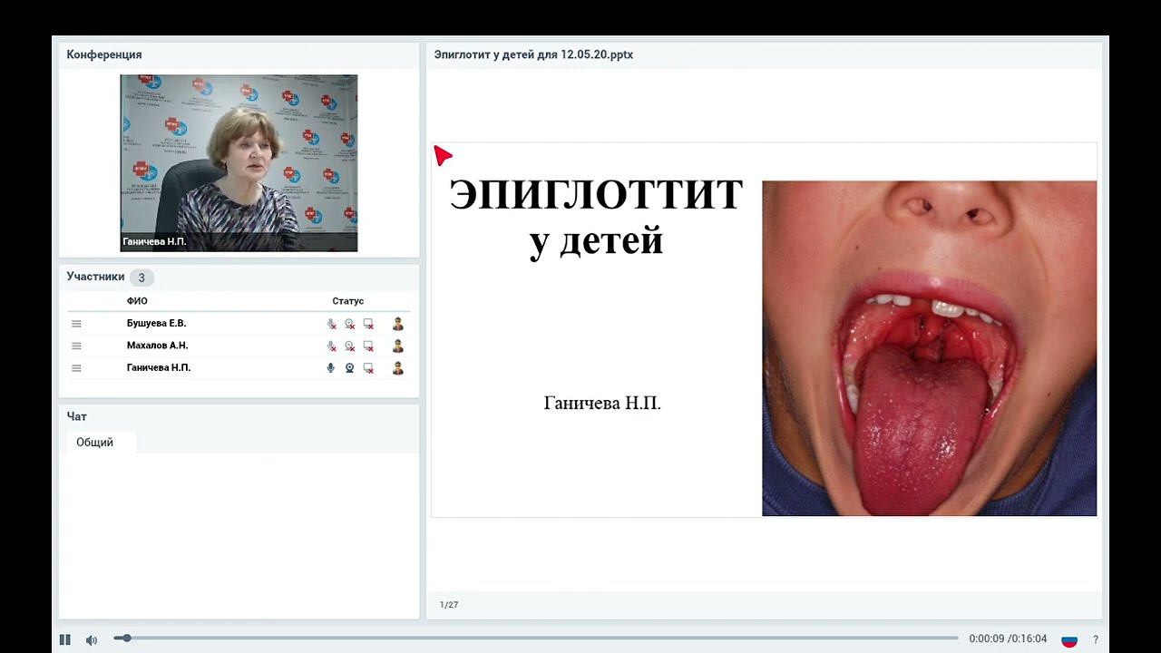 Эпиглоттит у детей.   Доцент Ганичева Н.П.
