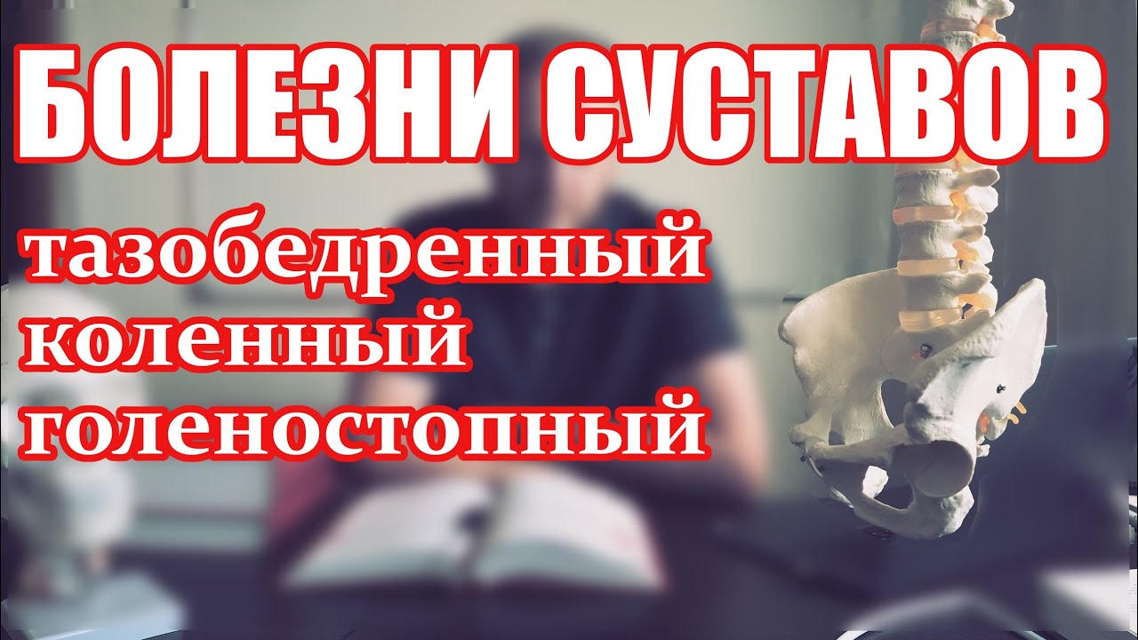 ? Болезни суставов: тазобедренный, коленный, голеностопный; артрит, артроз