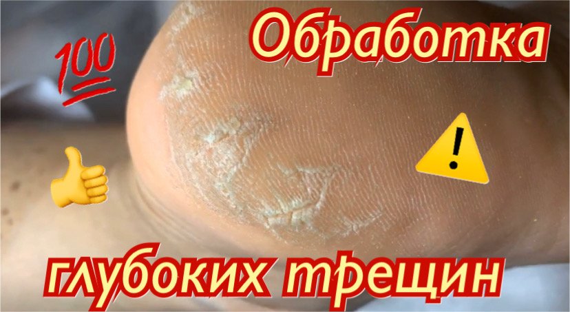Обработка глубоких трещин??⚠️?