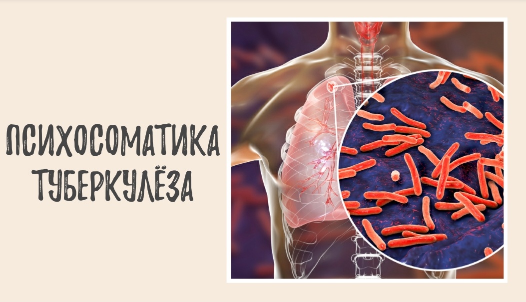 Психосоматика туберкулеза – туберкулез и его настоящие причины.