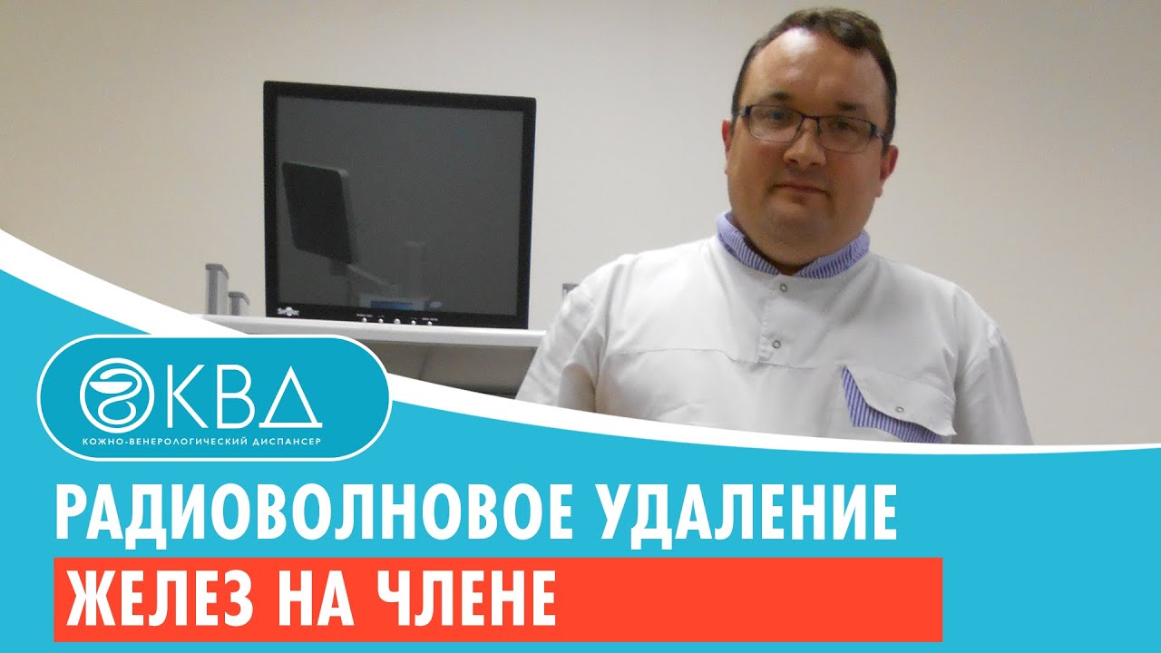 ✅ Радиоволновое удаление желез на члене. Клинический случай №265