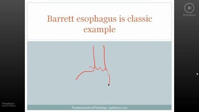 Pathoma USMLE - I ГЛАВА - 1.Адаптация к росту