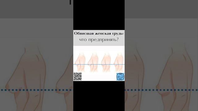 Обвисшая женская грудь: что предпринять?