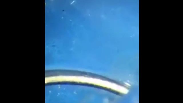 2020_05_29_Облитерированный мб2, разговоры о анатомии, S-flexy и прочие разговоры целый час.