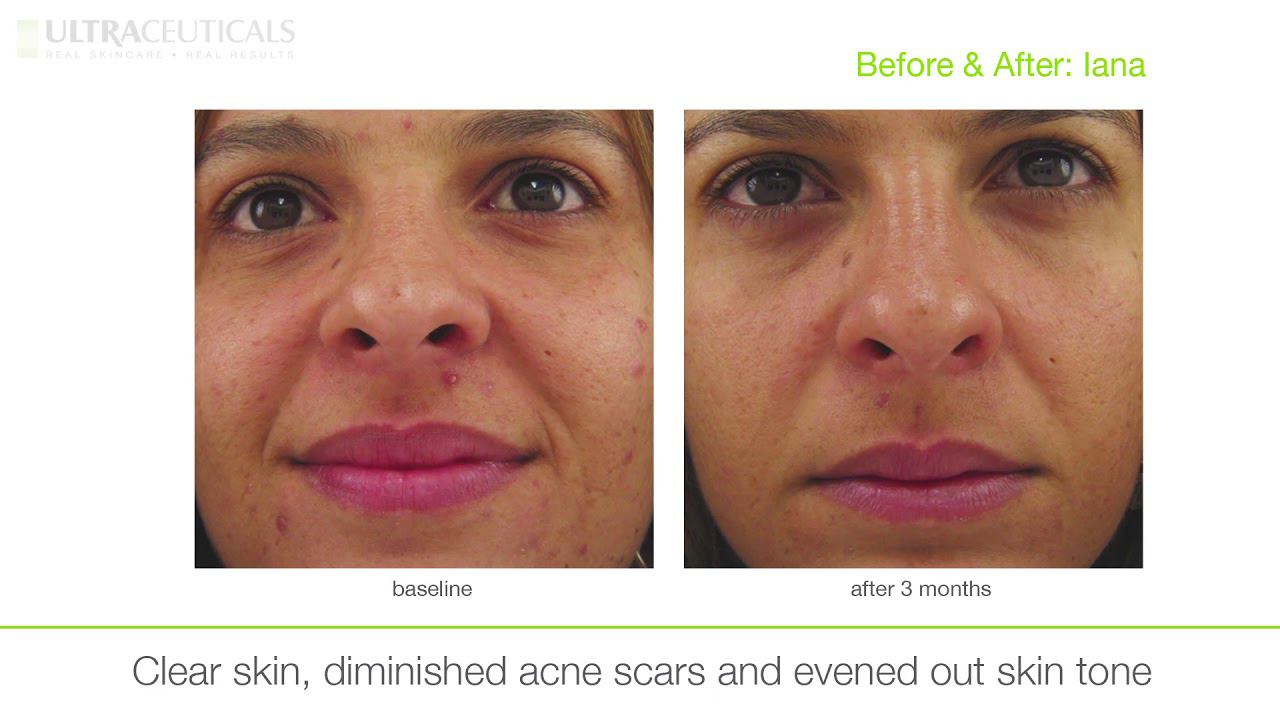 Ultraceuticals Instore Video