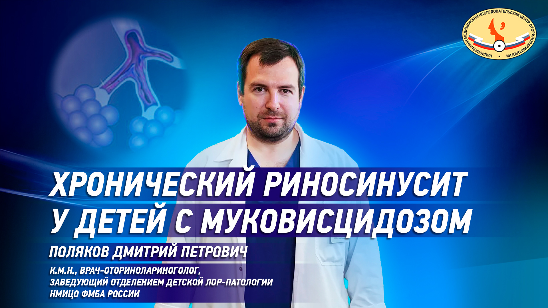 Хронический риносинусит у детей с муковисцидозом.