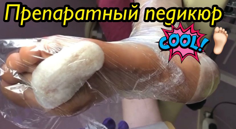 Препаратный педикюр ????