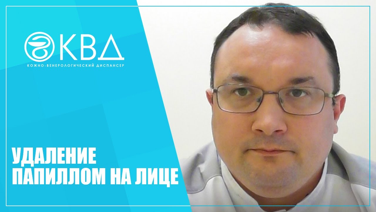 1183  Удаление папиллом на лице