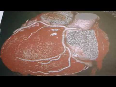 ЖИТЬ БЕЗ БОЛИ v1