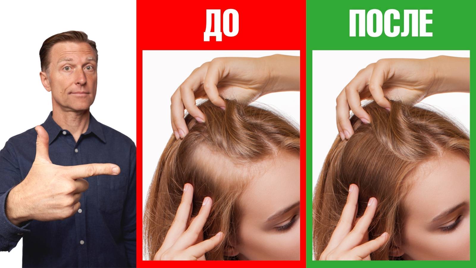 Как сделать волосы гуще? Простые советы👌