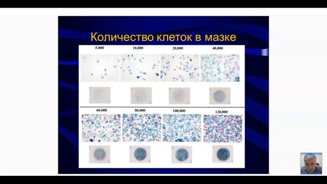 Морфология в онкологии.Часть1.mp4