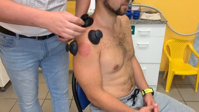 Плечо. Инструментальная мобилизация при помощи вакуумных банок. ИММТ/IASTM. Павел Коломиец.