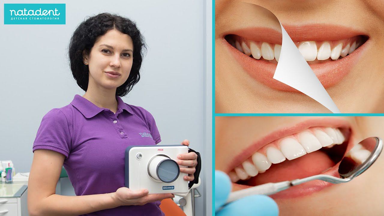 191. Полезно ли отбеливать зубы? Натадент
