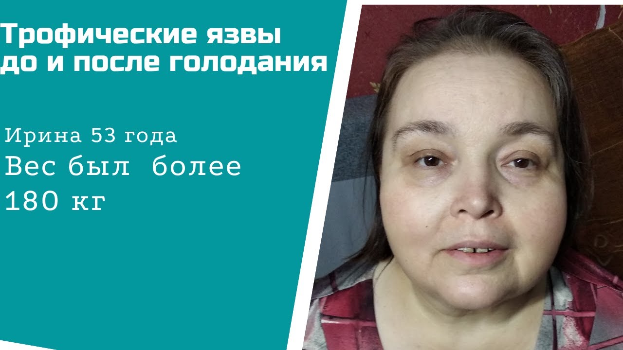 Трофические раны до  и после голодания.mp4