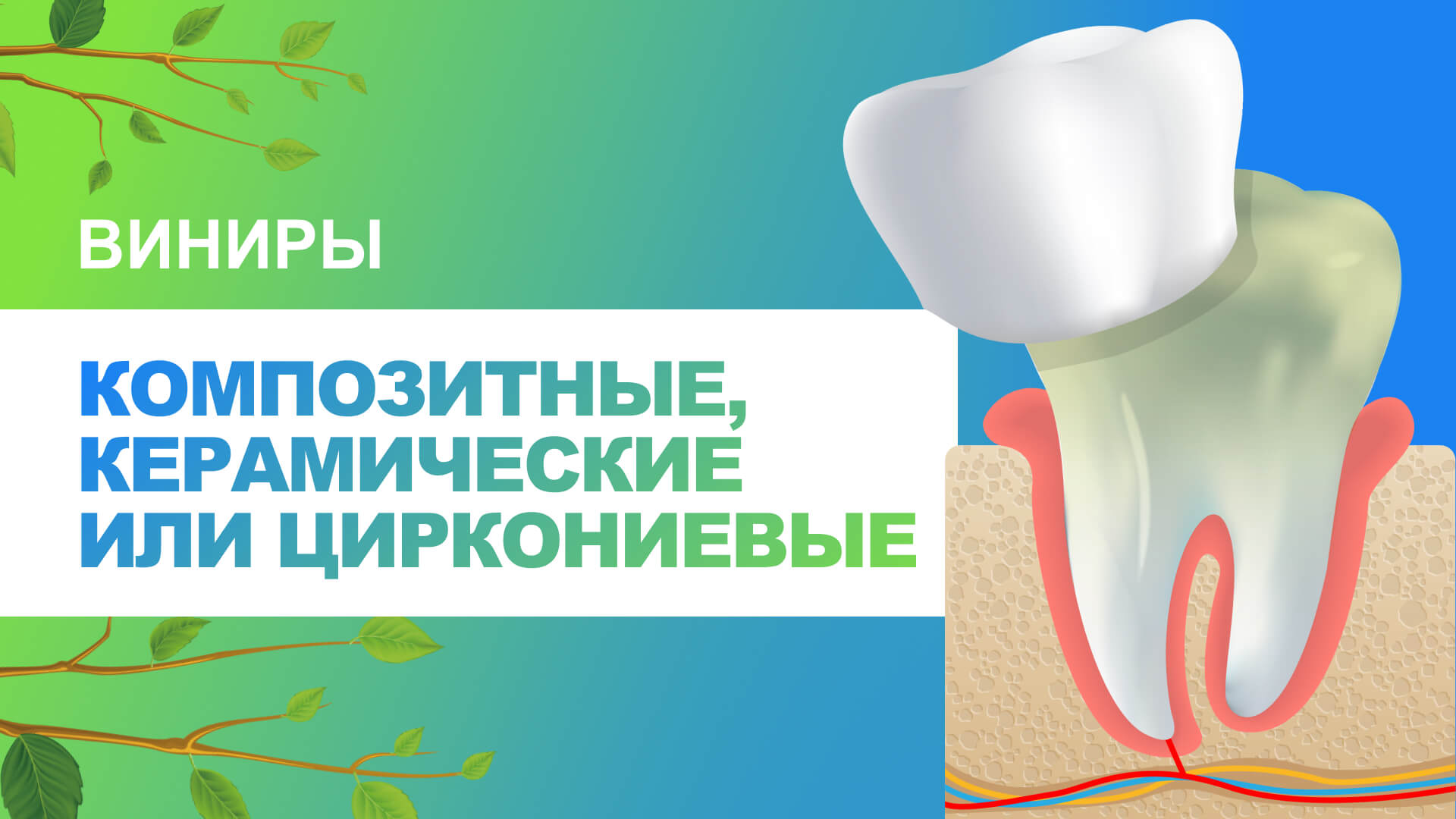 ? Виниры композитные, керамические или циркониевые