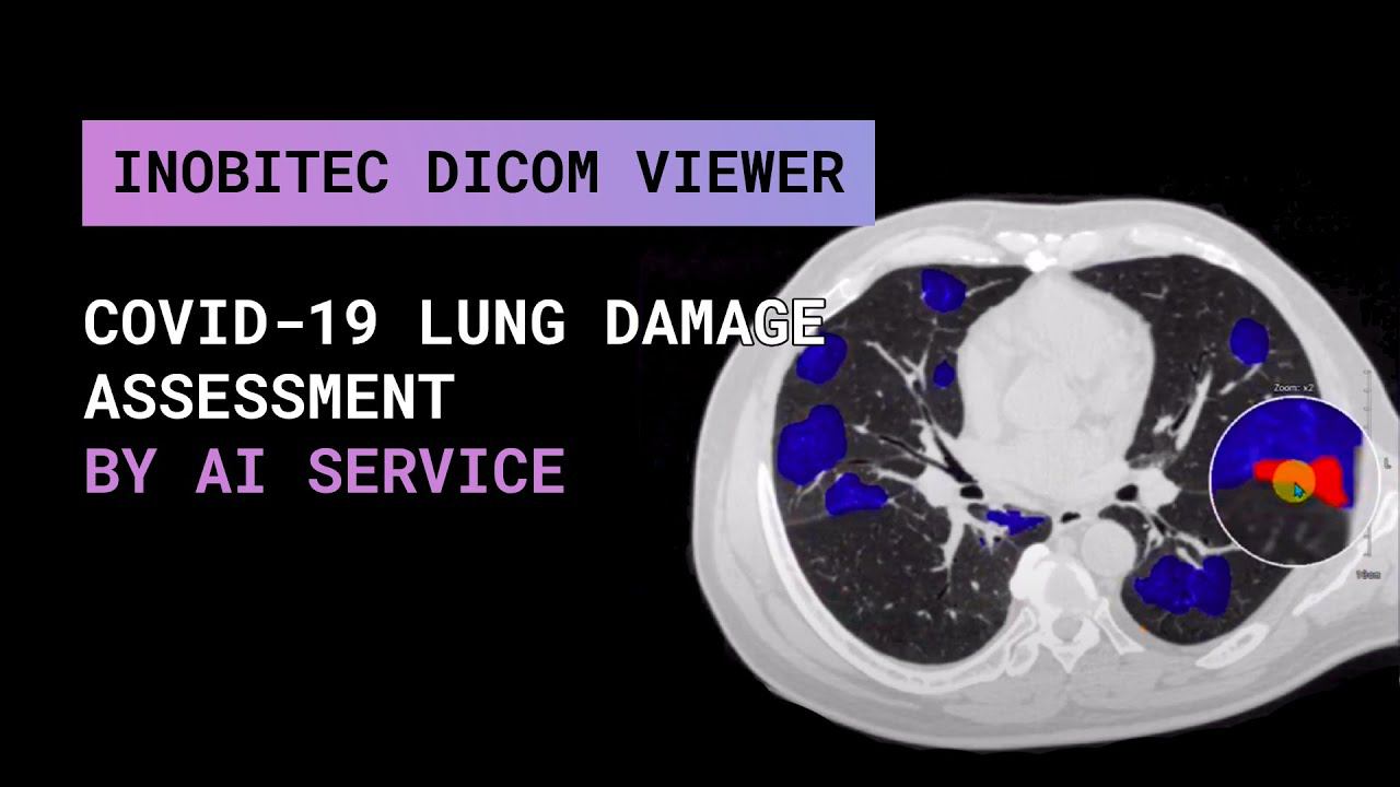 COVID-19 Оценка повреждения легких с помощью службы искусственного интеллекта