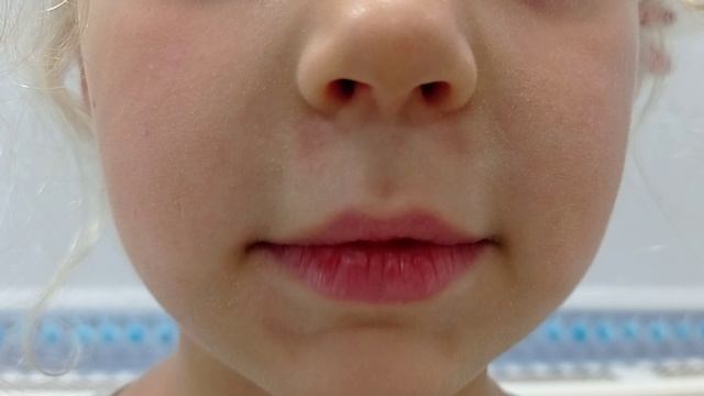 Виды сигматизма