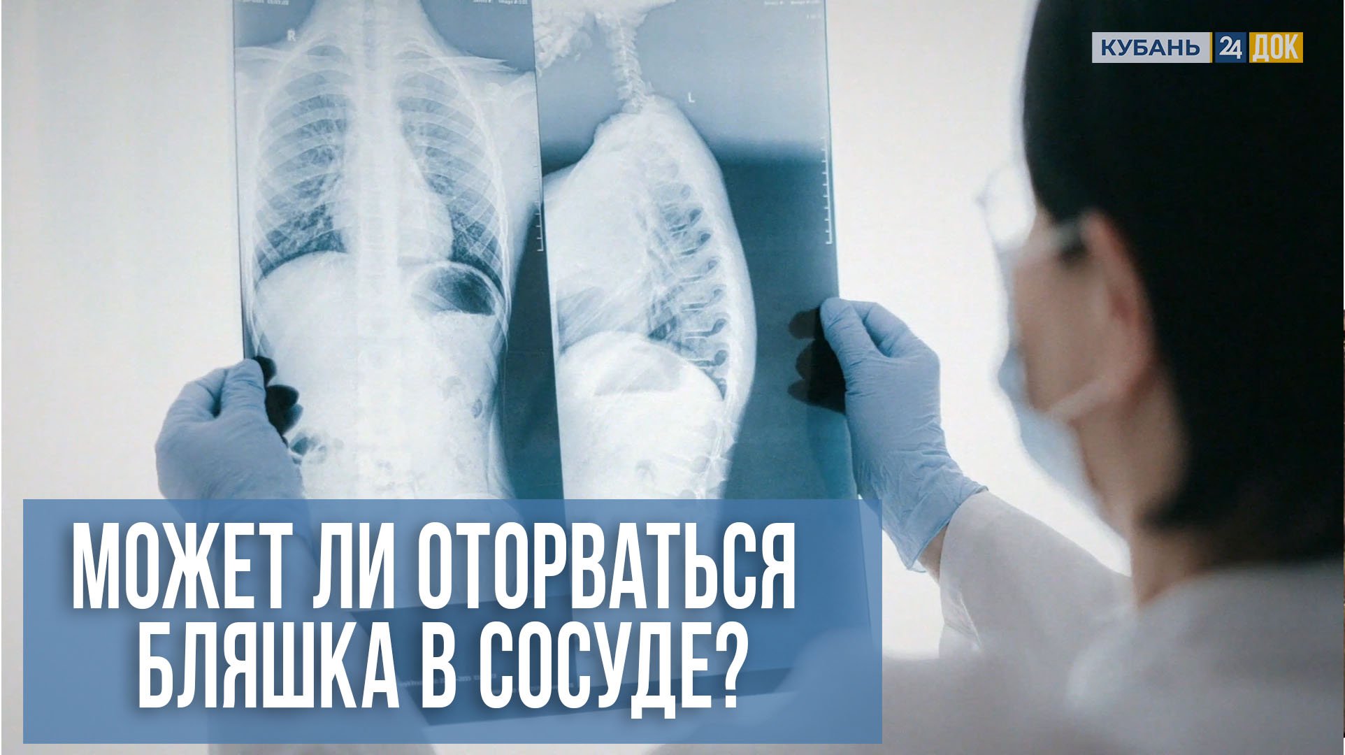 Атеросклероз бывает и у молодых. ИСТОРИЯ БОЛЕЗНИ